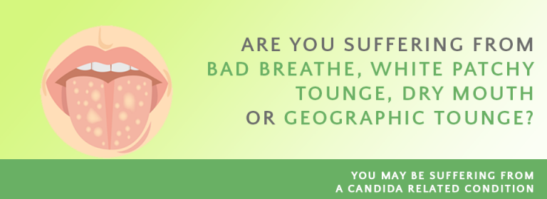 Thrush Treatment Center - Cure Oral Thrush Naturally