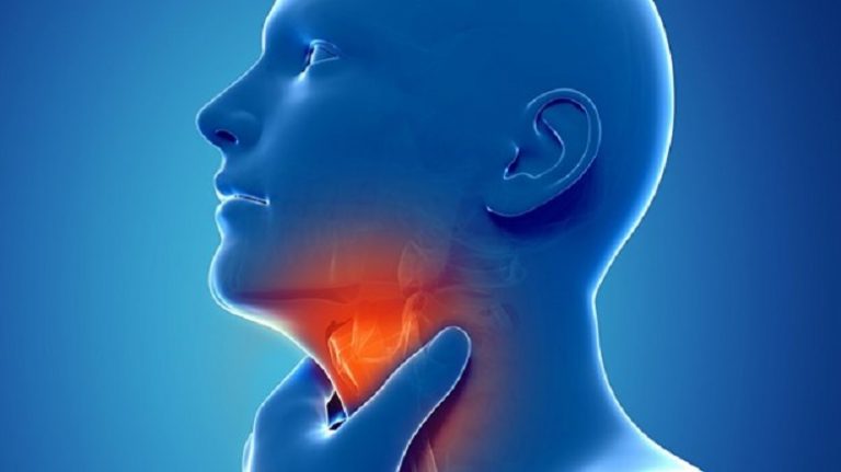 Thrush on the Throat (Esophageal Thrush)
